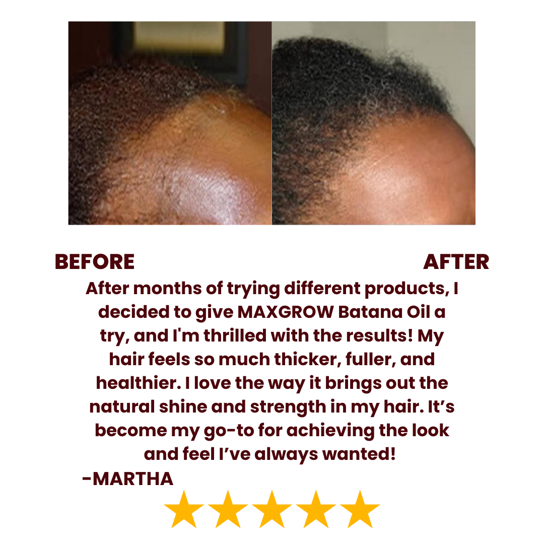 Batana Natural Hair Growth Oil – Maxgrow